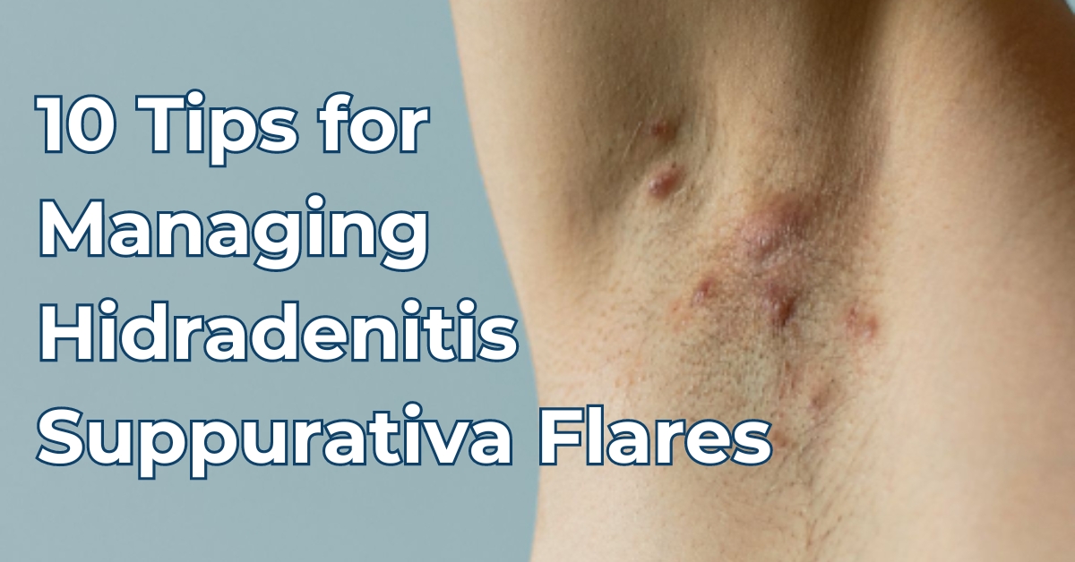 10 Tips for Managing Hidradenitis Suppurativa Flares | Amazing Ointments